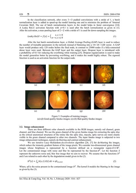 automated fundus image quality assessment and segmentation of optic