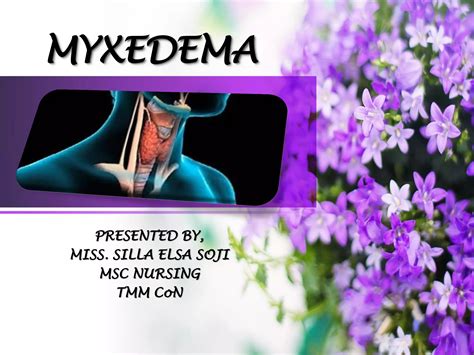 Management Of Myxedema Coma Ppt