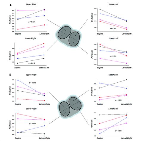 Regional Pulmonary Perfusion By Electrical Impedance Tomography Of Download Scientific