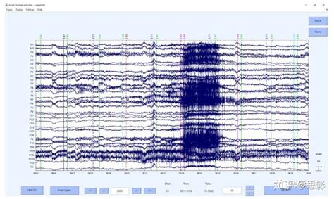 EPOSEEG处理开源脚本 知乎
