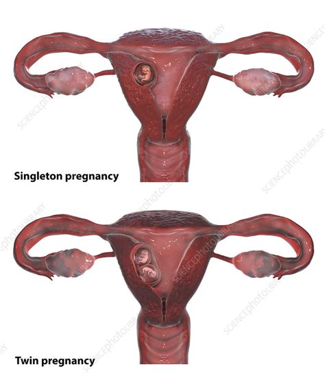 Singleton And Multiple Pregnancy Illustration Stock Image F034