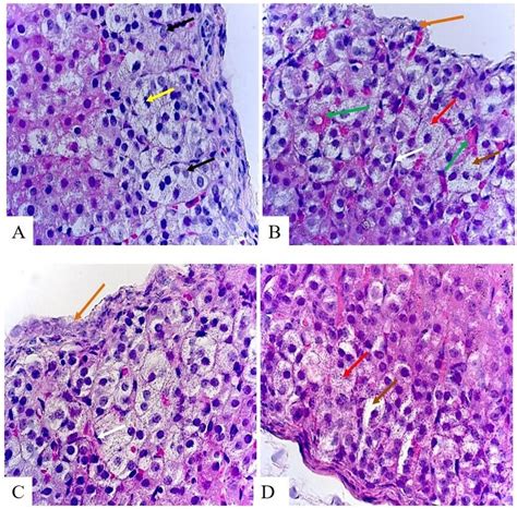 Capsule And Zona Glomerulosa Of The Adrenal Glands Of Rats From The