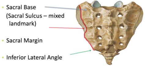 Sacral Sulcus Landmark