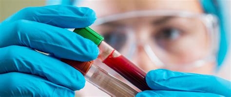 Understanding Multiple Myeloma Lab Results