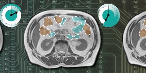 Unetr Model Tensorflow Kaggle