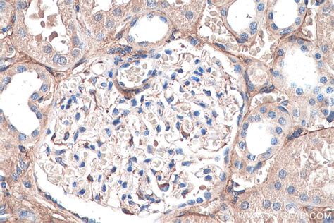 Biglycan Antibody 16409 1 AP Proteintech