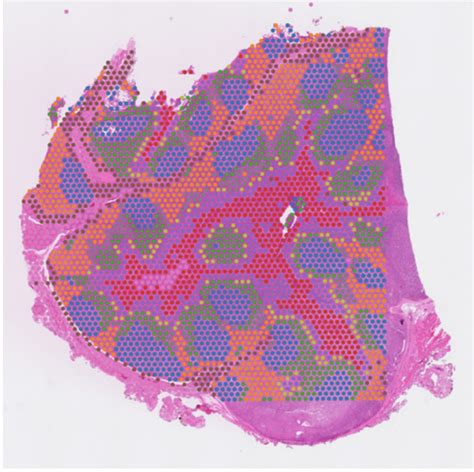 Spatial Transcriptomics Services Center For Cellular Profiling