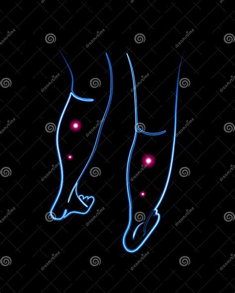 Varicose Veins Of The Legs Treatment Of Varicose Veins Stock Vector