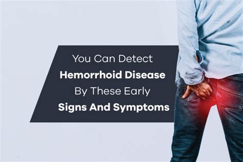 You Can Detect Hemorrhoid Disease By These Early Signs And Symptoms