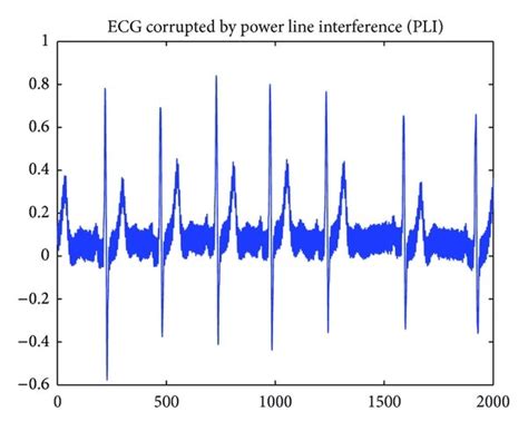 Frequency Spectrum Of The Ecg Signal A Having Power Line Interference Download Scientific