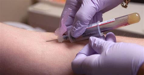 Lifelabs To Make Patients Test Results Available Online