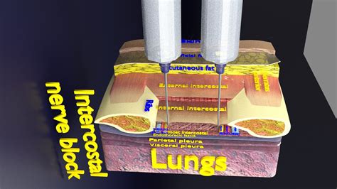 Artstation 3d Thoracic Thorax Procedures Animated Resources