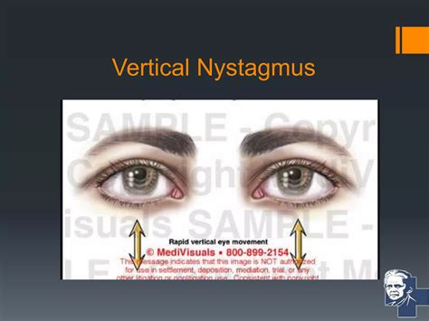 Vestibular Function Test Ppt
