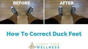 How To Fix Duck Feet Posture Explained And Best Videos Curation PostureInfoHub