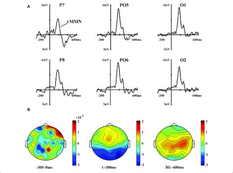 A Mismatch Negativity Mmn Waveforms Obtained By Subtracting The