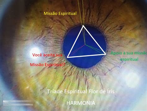 Iridologia O Significado Dos Principais Tipos E Sinais🥢 Descubra O