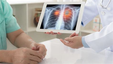 Janssen Celebrates An Early Win For Nipocalimab In Hdfn Clinical Trials Arena