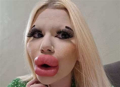 Woman With The Worlds Biggest Lips Says Men Want To Take Her On Dates