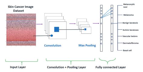 skin disease detection using cnn convolutional neural