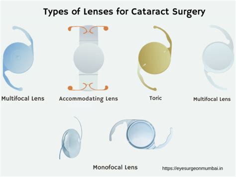 Cataract Surgery Best Lenses Multifocal IOLs Lenses
