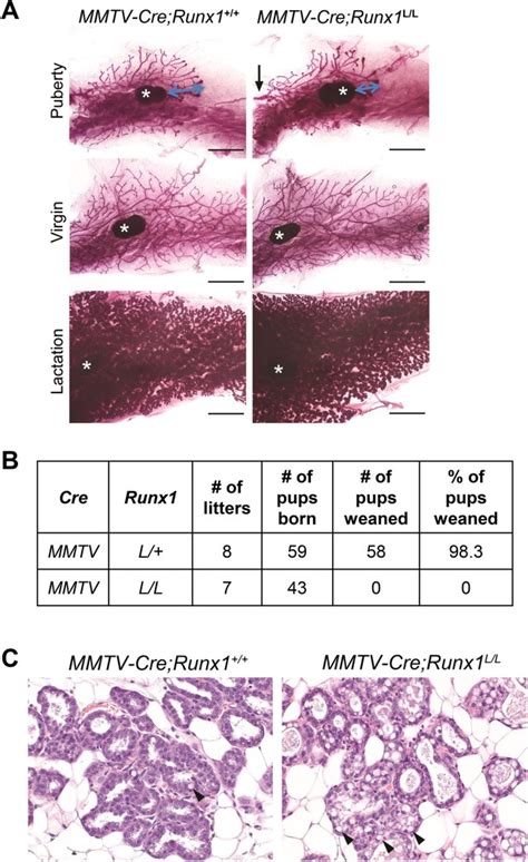 Figures And Data In Runx A Transcription Factor Mutated In Breast Cancer Controls The Fate Of