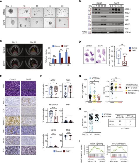 Myc Drives Temporal Evolution Of Small Cell Lung Cancer Subtypes By Reprogramming Neuroendocrine