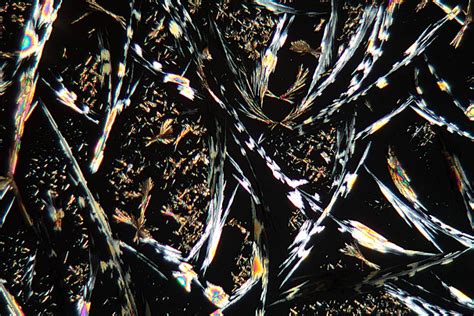 Cholesterol Crystals Under The Microscope Metabolism Biosynthesis