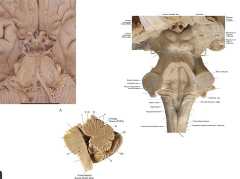 Neurology Wet Lab Practical Diagrams 4 Diagram Quizlet