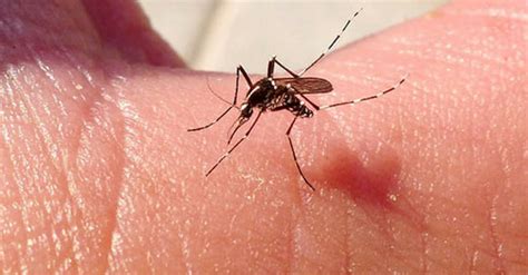 Picaduras De Mosquitos Remedios Caseros