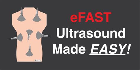Ultra Pocus 101