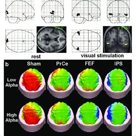 Effects Of Left And Right Posterior Parietal Cortex Ppc Transcranial