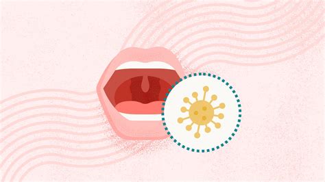 Mono Mononucleosis Diagnosis And Treatment