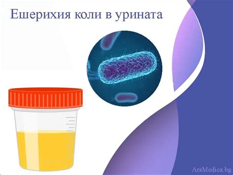 Бактерии в урината бактериурия Arsmedica Bg