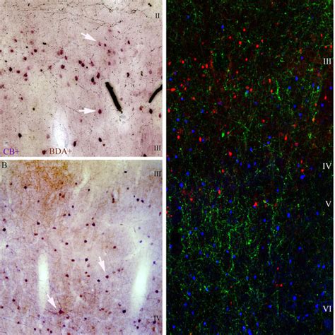 Relationship Of Prefrontal Pathways To Neurochemical Classes Of Download Scientific Diagram