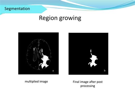 Automatic System For Detection And Classification Of Brain Tumors Ppt