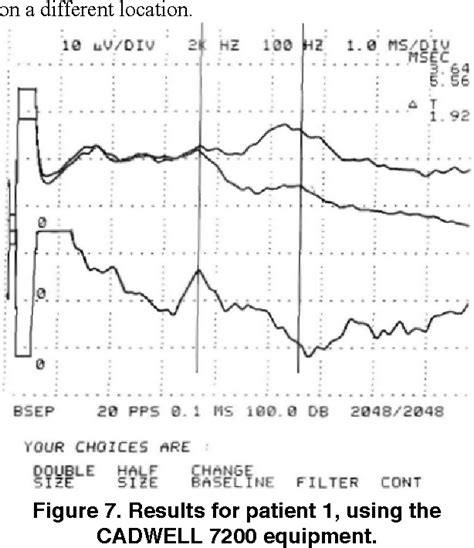 Figure From Design And Construction Of An EEG Data Acquisition System For Measurement Of