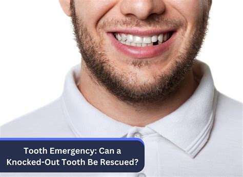 Tooth Emergency Can A Knocked Out Tooth Be Rescued