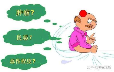 68ga Fapi Petct在恶性肿瘤诊断中的妙用 知乎
