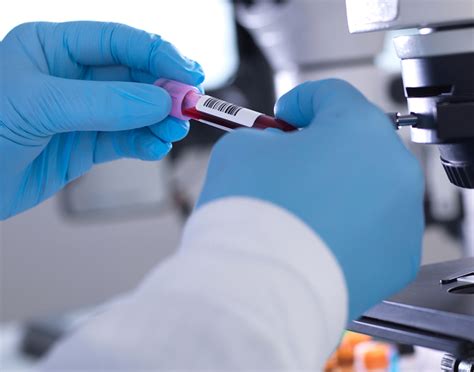 Tips For Proper Psa Test Coding Aapc Knowledge Center 40 Off
