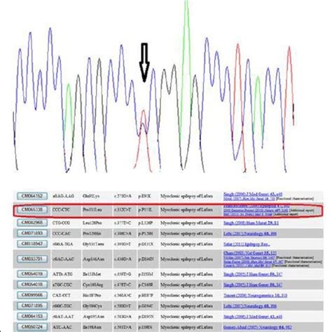 In The Genetic Test Of Case 1 Heterozygous C332ct Pp111l Mutation