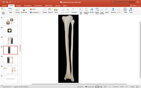 Tibia And Fibula Diagram Quizlet