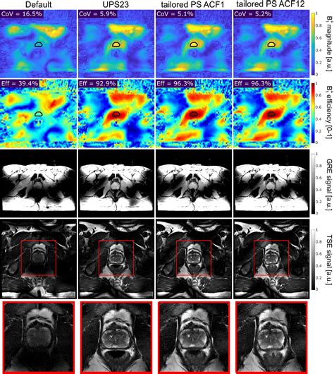 New Paper Accelerated B1 Mapping And Robust Parallel Transmit Pulse Design For Heart And