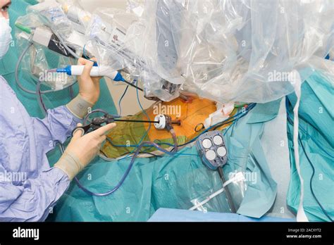 Da Vinci Robotic Prostatectomy Removal Of All Or Part Of The Prostate Gland The Da Vinci