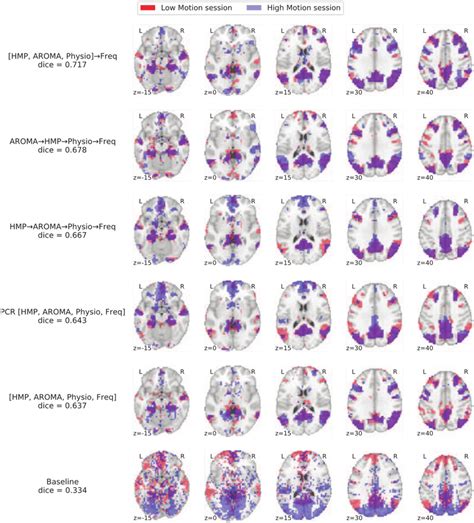 Graphical Comparison Of Pipeline Testretest Reliability Of Group Level Download Scientific