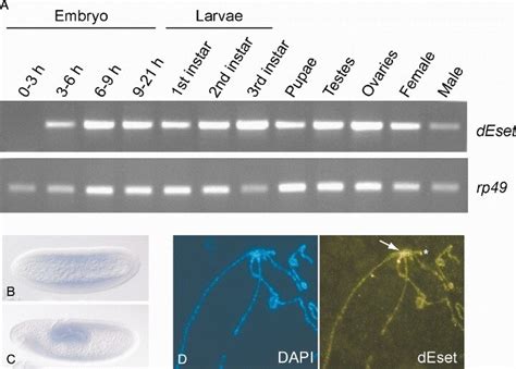 Ad Spatio Temporal Expression Deset A Developmental Rt Pcr Of