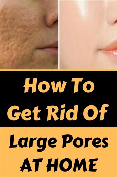 How To Get Rid Of Large Pores SKINCARE