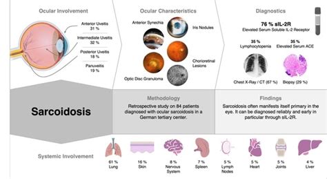 Findings And Graduation Of Sarcoidosis Related Uveitis A Single Center