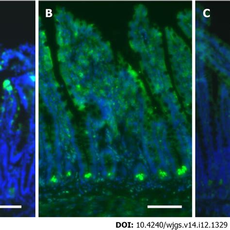 Intestinal Stem Cell Injury By Ischemia Reperfusion Injury A