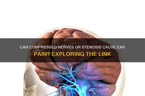 Can Compressed Nerves Or Stenosis Cause Ear Pain Exploring The Link