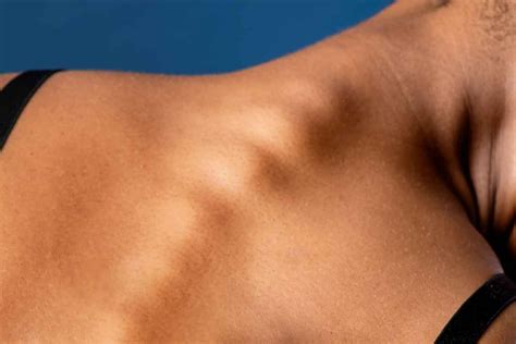 Understanding Vertebral Subluxation And The Benefits Of Upper Cervical